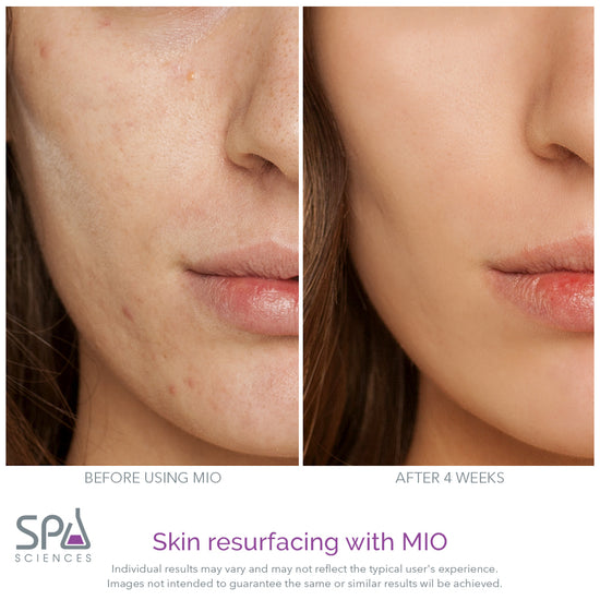 MIO – Spa Sciences